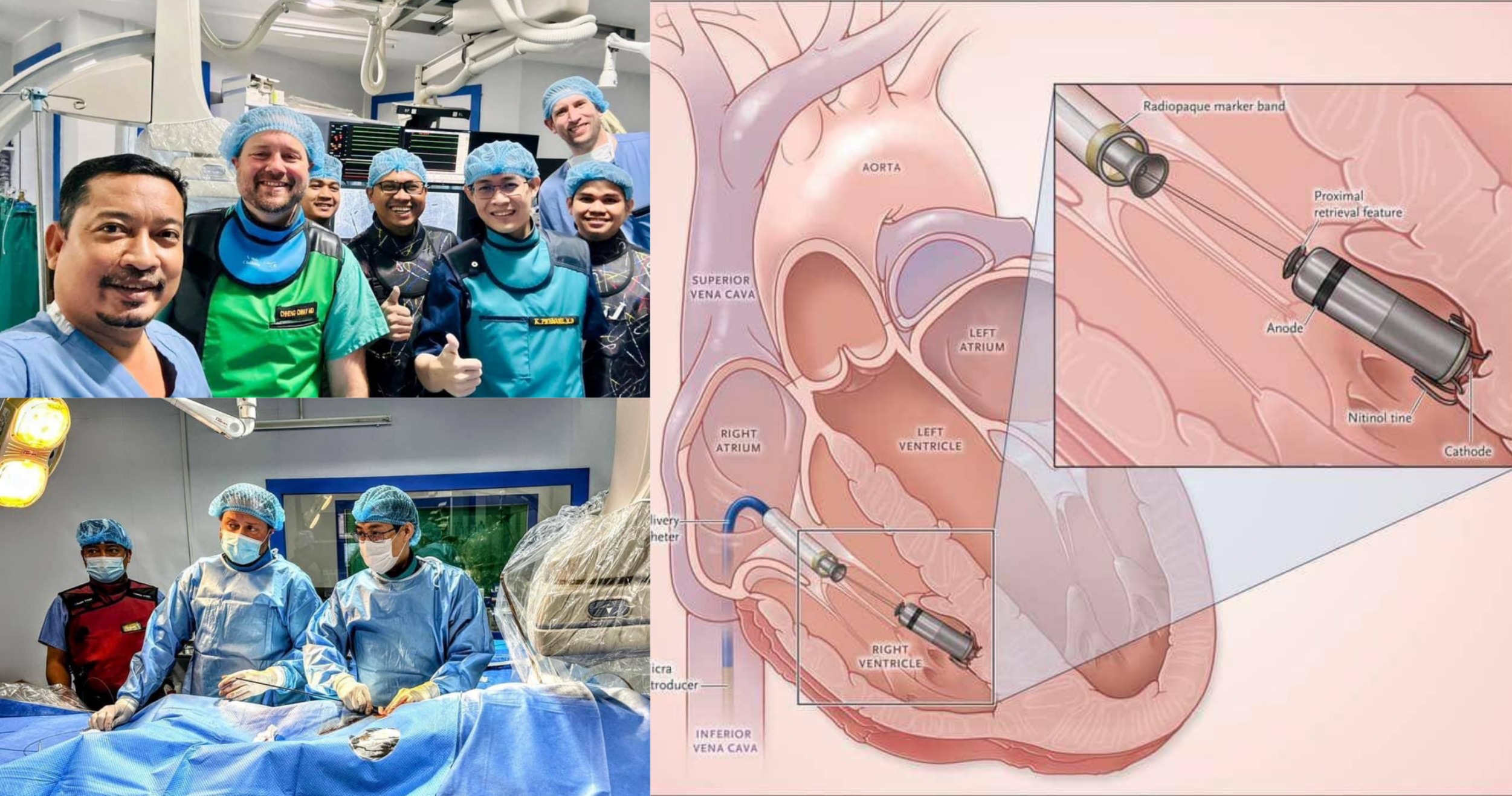 ជាករណីលើកដំបូងទី ១ ...